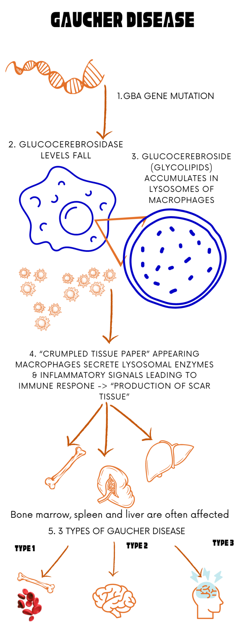 G for Gaucher Disease – Part I – MedNess