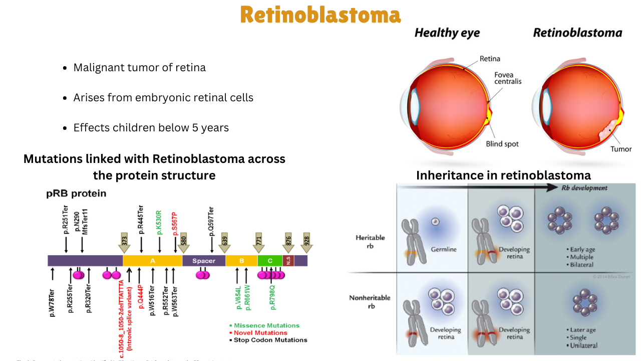 R For Retinoblastoma- Part I – MedNess